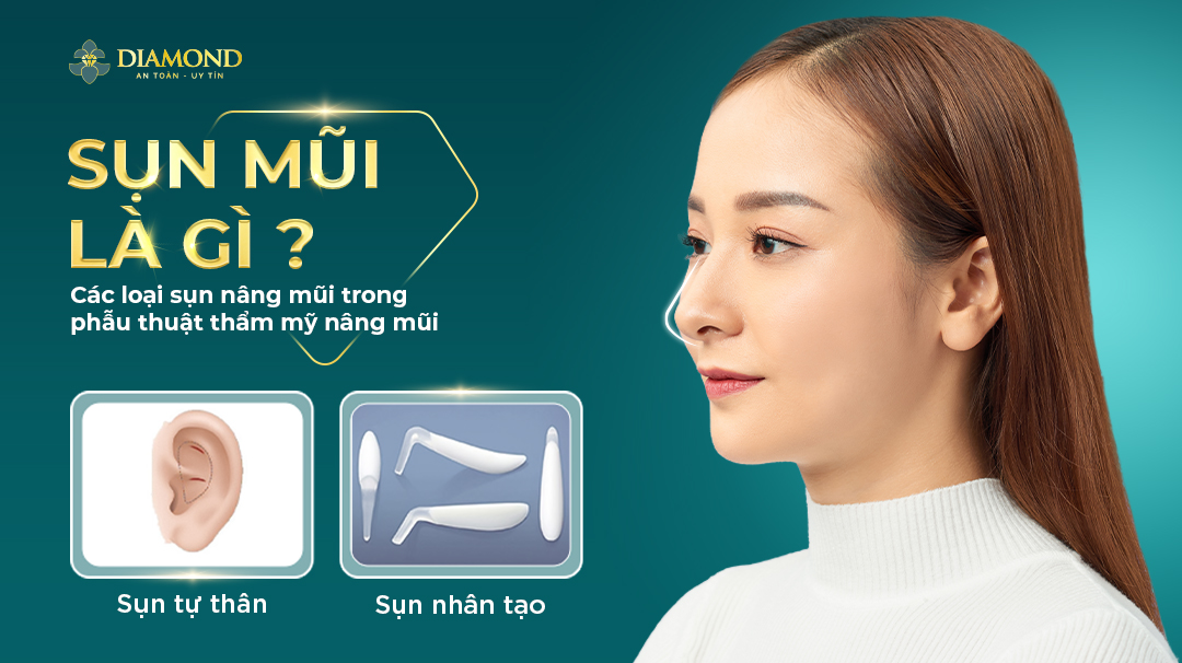 Sụn mũi là gì? Các loại sụn nâng mũi trong phẫu thuật thẩm mỹ nâng mũi